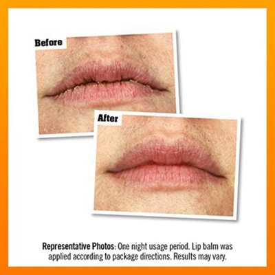 O'Keeffe's Lip Repair Set Overnight Lip Balm 7g + SPF Lip Balm 4.2g for ...